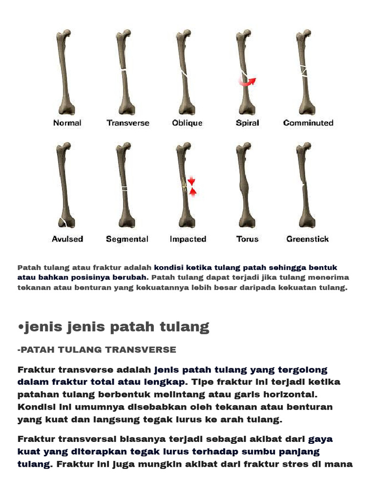 Jenis Dan Penyebab Patah Tulang | PDF