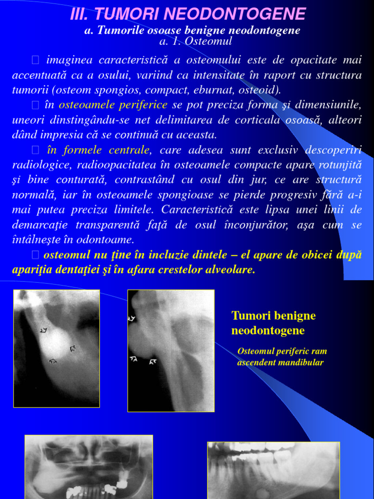 Tumori Neodontogene | PDF