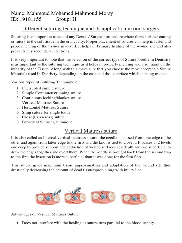 Suturing Techniques Maxillo | PDF