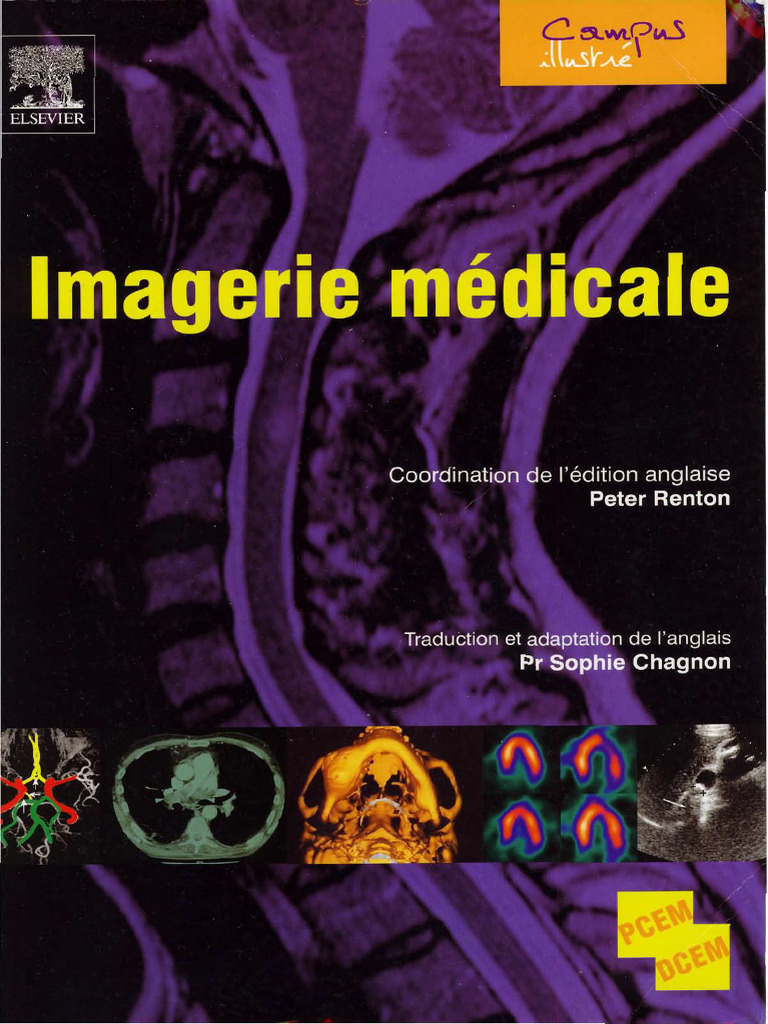 imagerie-medicale | PDF