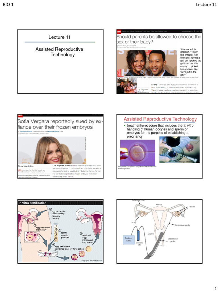 Lecture 11 - Assisted Reproductive Technology | PDF