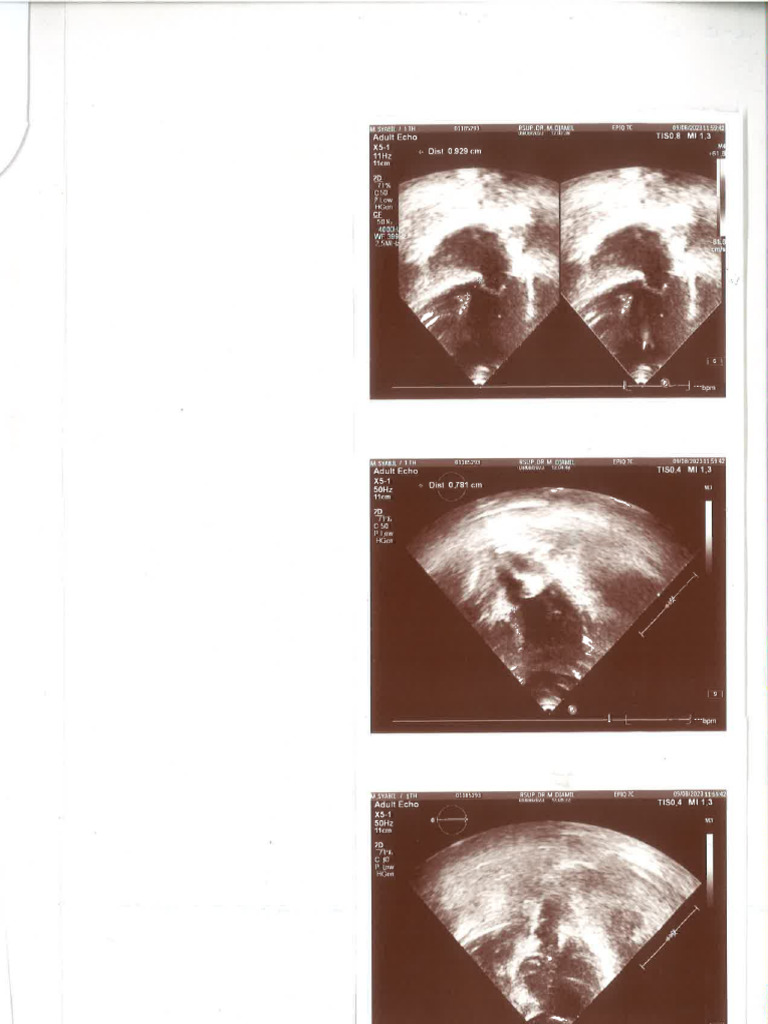 Echo 2 | PDF