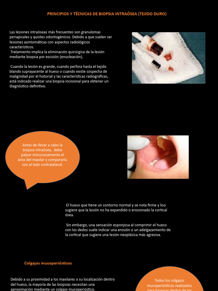 Biopsia Intraósea: Técnicas y Manejo | PDF | Biopsia | Hueso