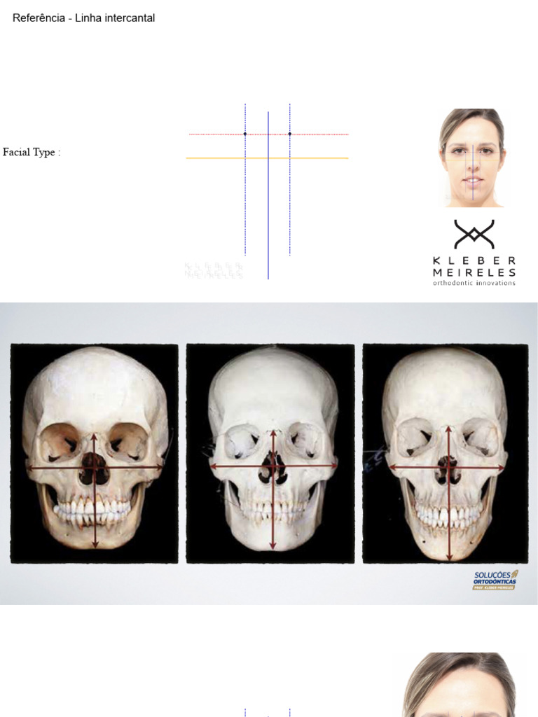 Template Facial Analysis Pdf