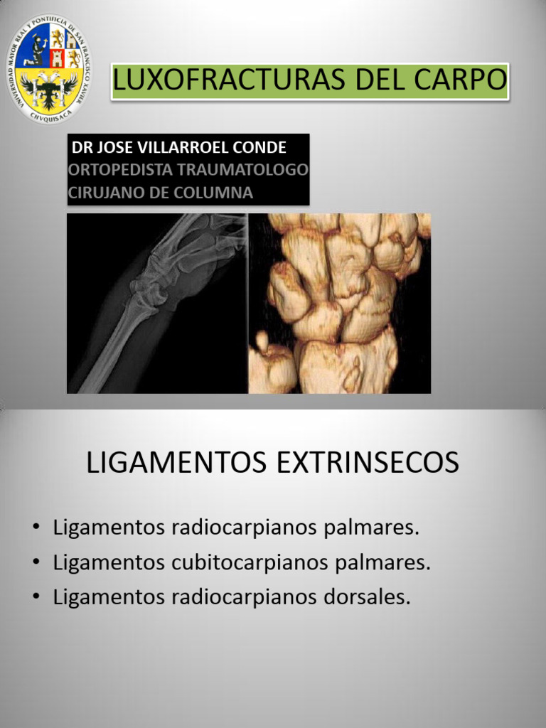 Luxofracturas del Carpo: Diagnóstico y Tratamiento | PDF | Mano ...