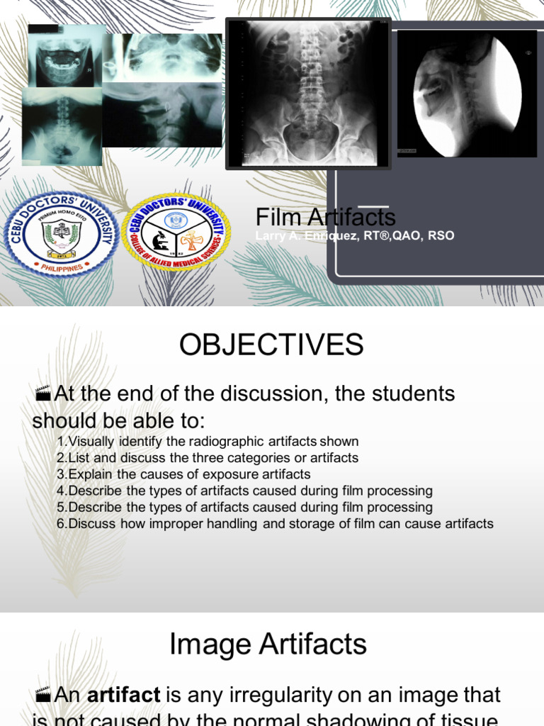 Image Artifacts | PDF