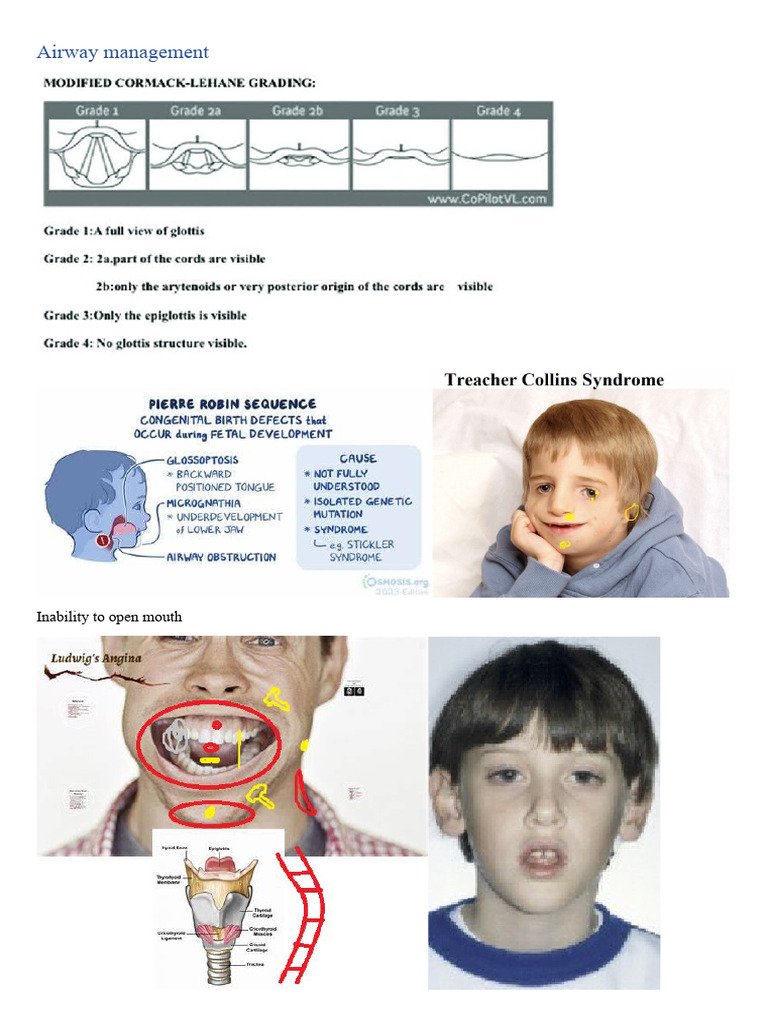 Anaesthesia notes | PDF | Anesthesia | Injury