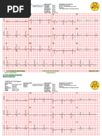 Universal ECG Sample Reports | PDF | Electrocardiography | Heart