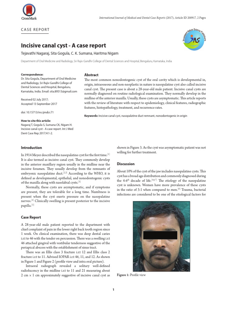 Incisive Canal Cyst A Case Report | PDF | Health Sciences | Medicine