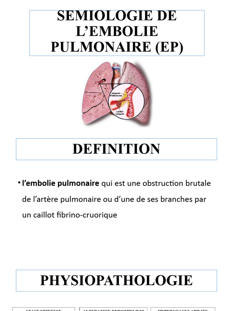 Signes et diagnostic de l'embolie pulmonaire | PDF | Poumon | Médecine ...