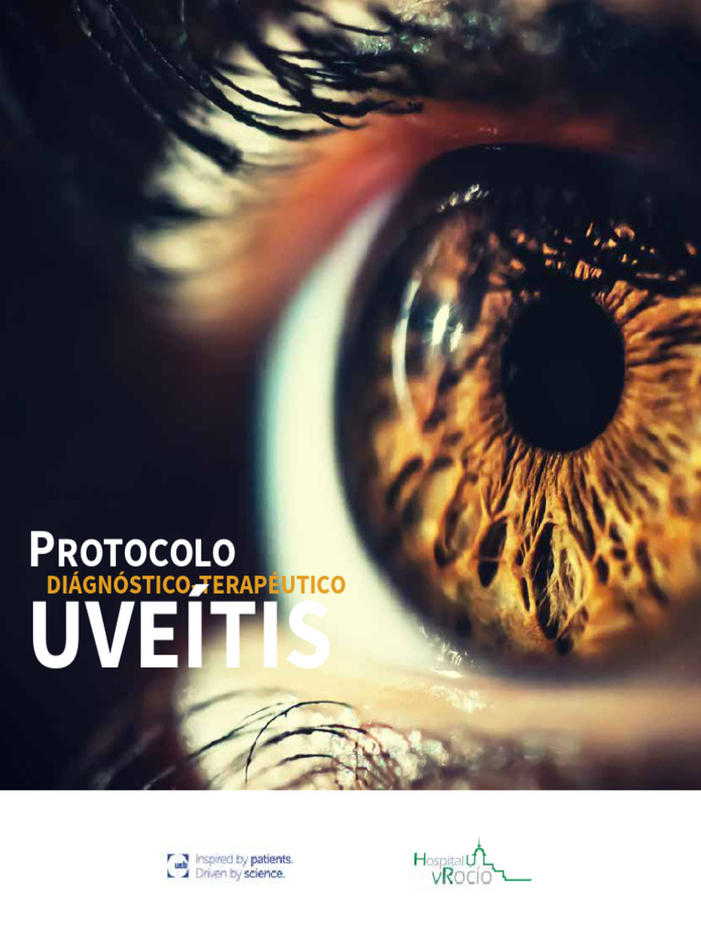 Guía Uveítis | PDF | Corticosteroides | Especialidades Medicas