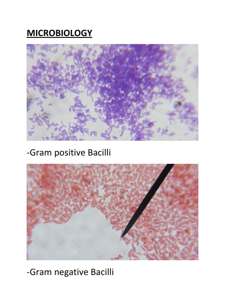 Microbiology Gram Positive Bacilli Pdf Science Mathematics
