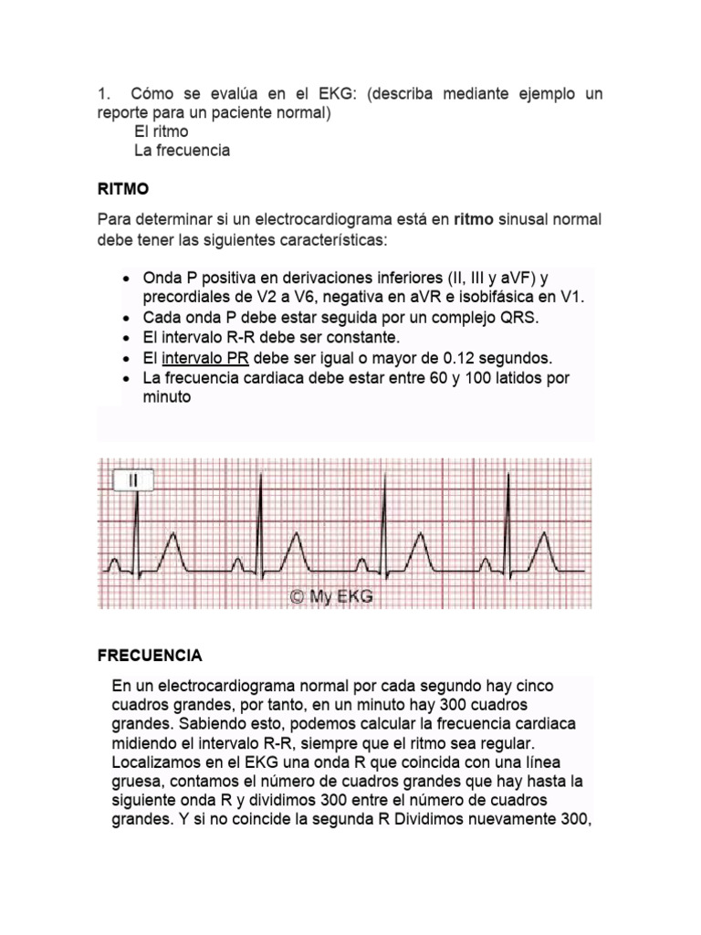 Taller EKG | PDF