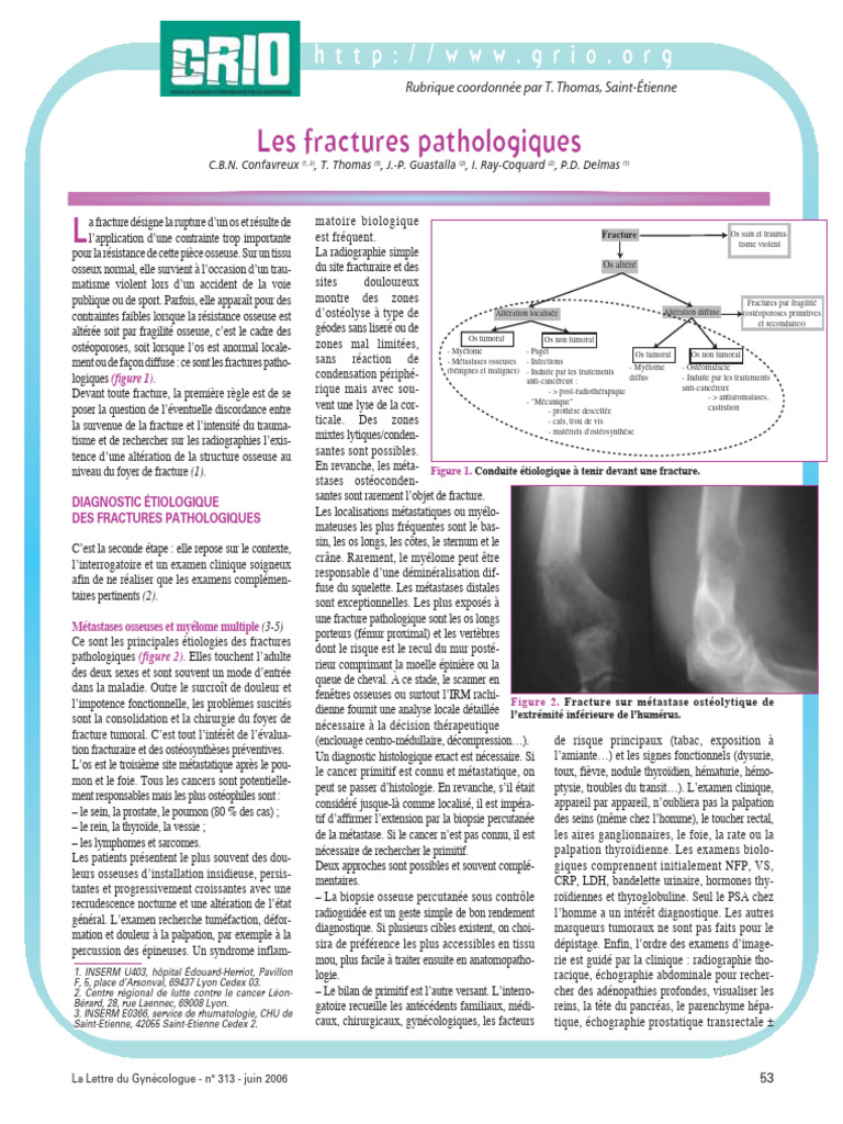 Fractures Pathologiques et Métastases Osseuses | PDF | Os | Métastase