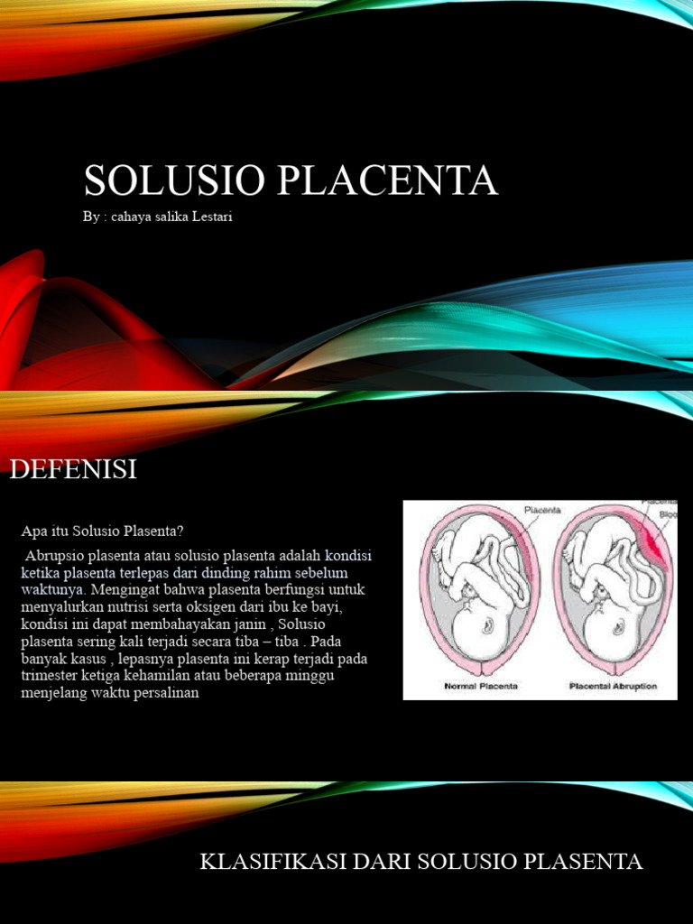 Solusio Plasenta | PDF