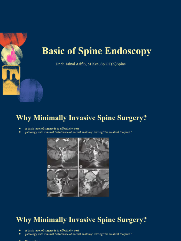 Basic of Spine Endoscopy | PDF