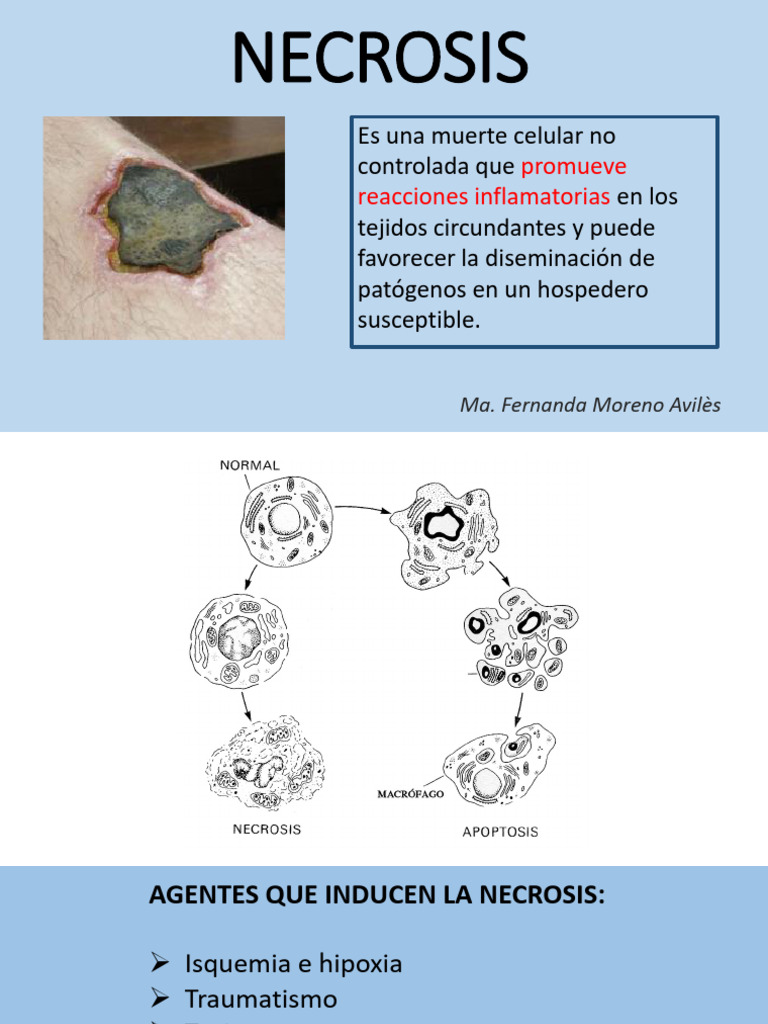 NECROSIS | PDF | Biología Celular) | Inflamación