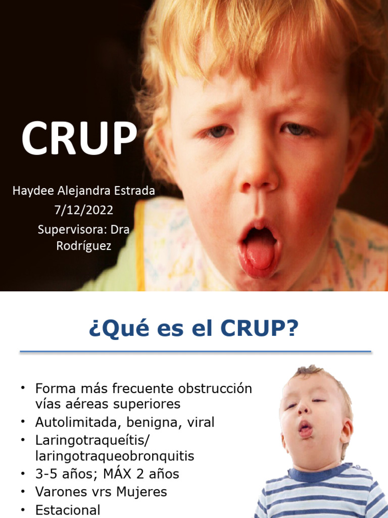 CRUP | PDF | Inmunología | Otorrinolaringología