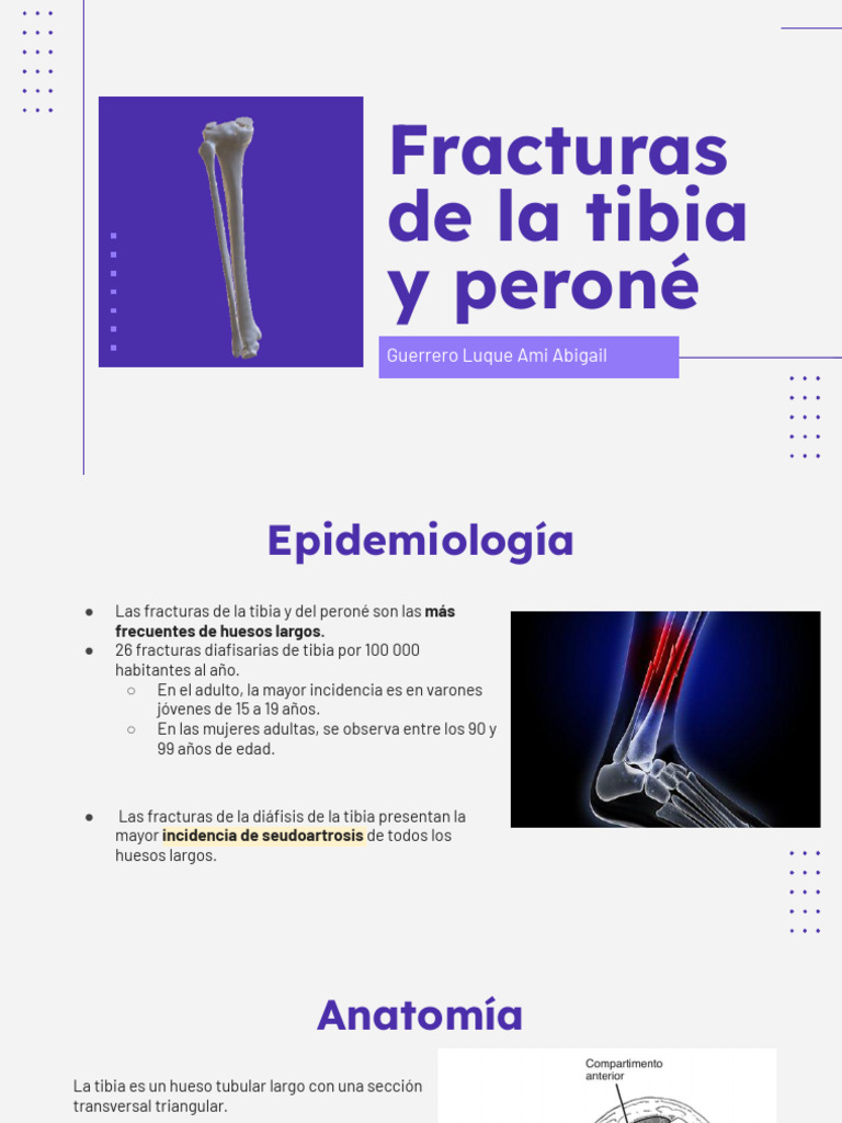 4 - Tibia y Peroné | PDF | Rodilla | Tobillo