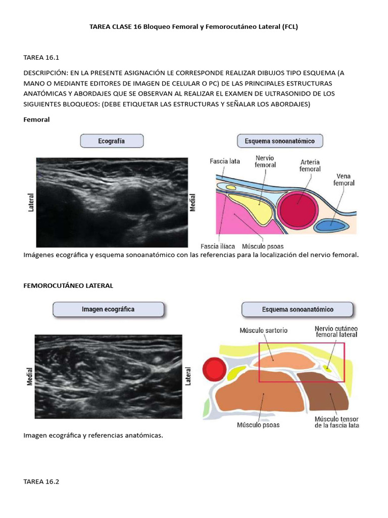 TAREA CLASE 16 - Compressed-1 | PDF