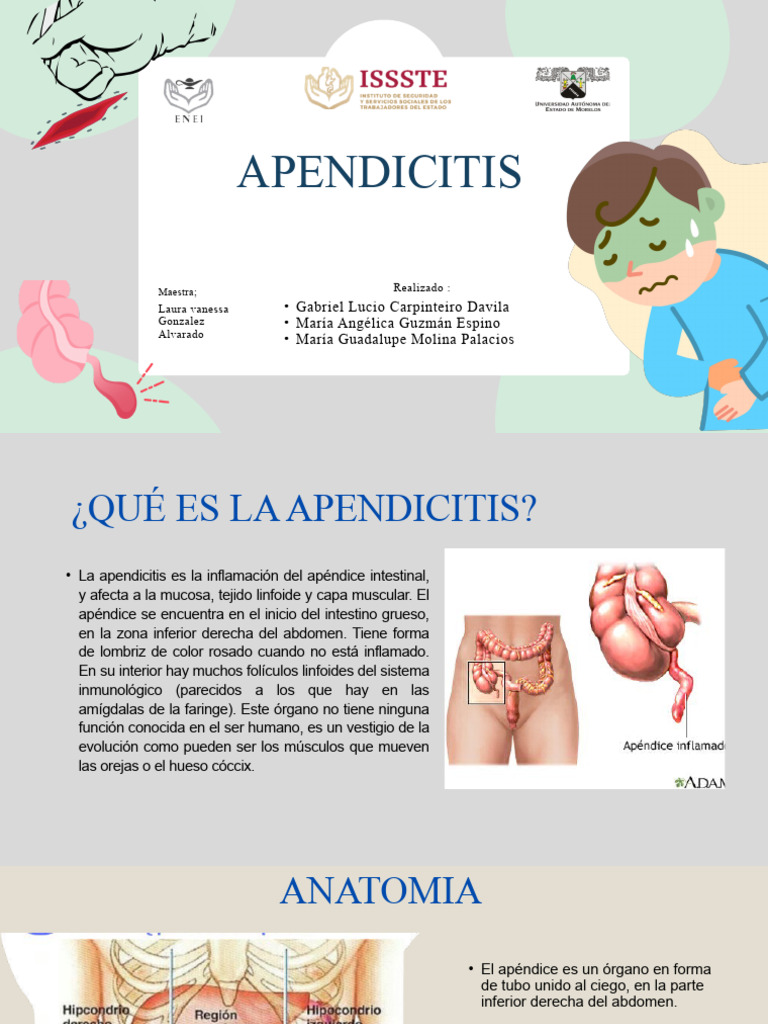 Apendicitis Pptx Gabriel Pdf
