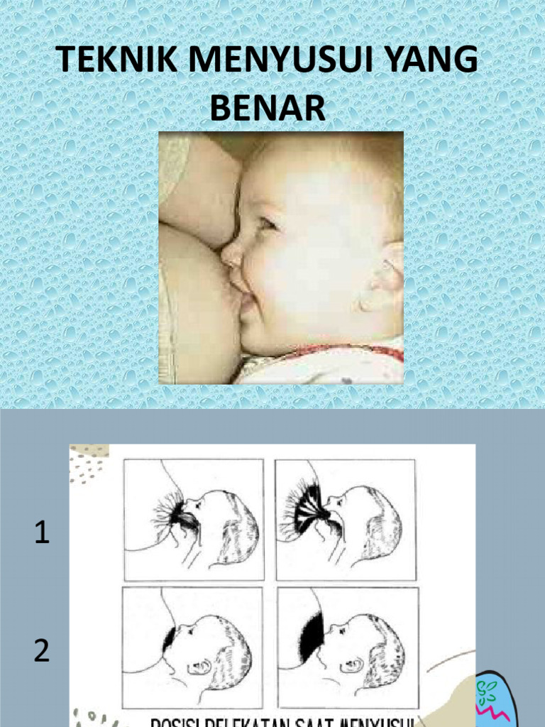 Cara Menyusui Yang Benar | PDF