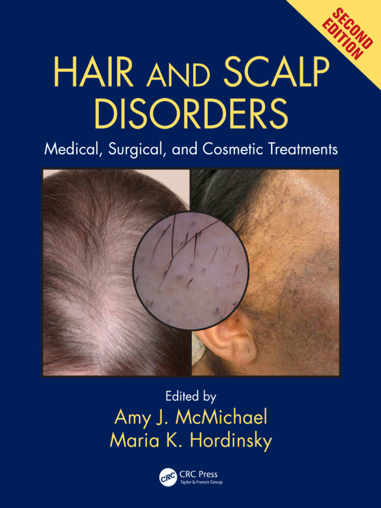 Pocketbook of Hair and Scalp Disorders (PDFDrive) | PDF | Hair ...