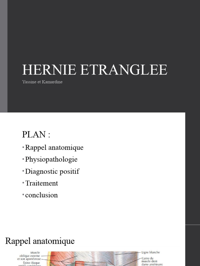 Hernie Étranglée : Diagnostic et Traitement | PDF | Médecine clinique | Maladies et troubles
