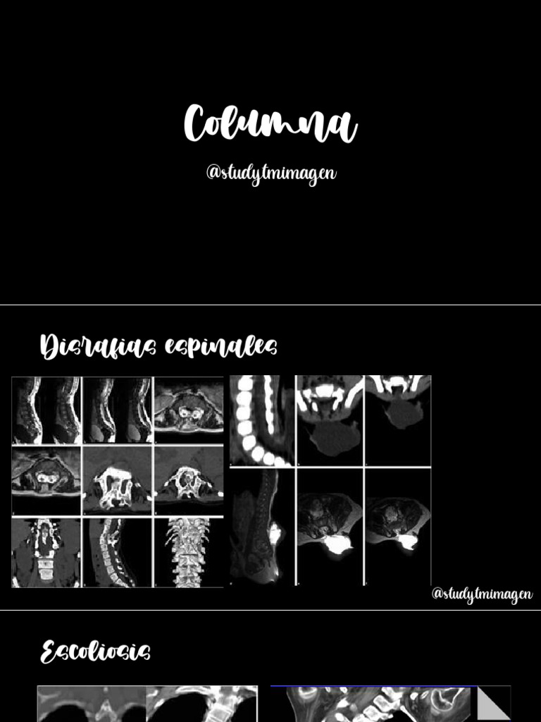 Imágenes TC Columna | PDF