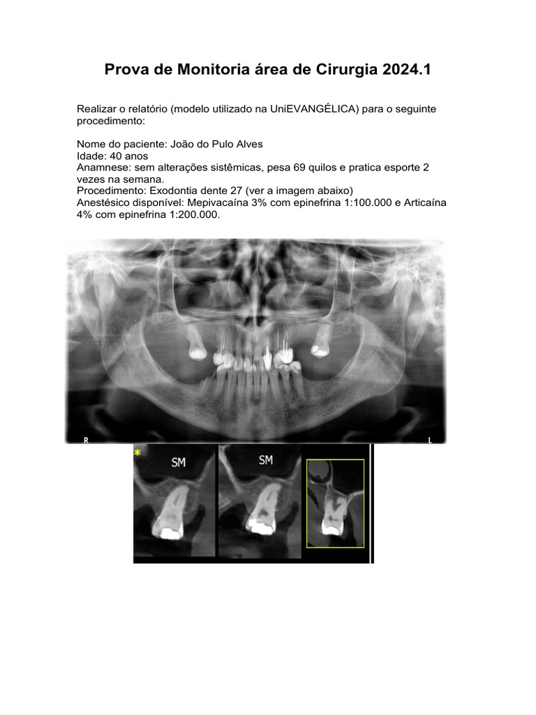 Prova de Monitoria Cirurgia | PDF