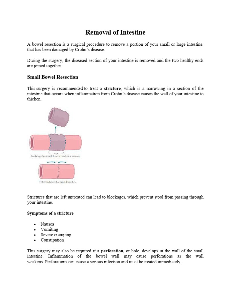 Removal of Intestine 1 | PDF | Small Intestine | Gastrointestinal Tract