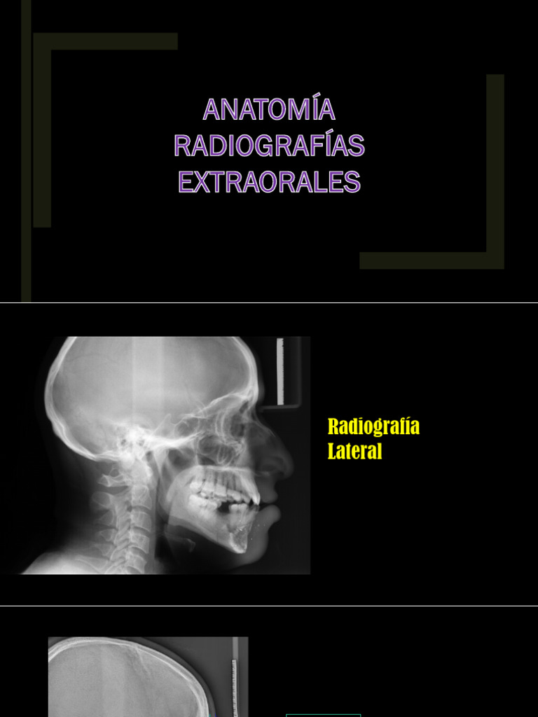 ANATOMIA EN RX EXTRAORALES | PDF | Anatomía | Anatomía humana