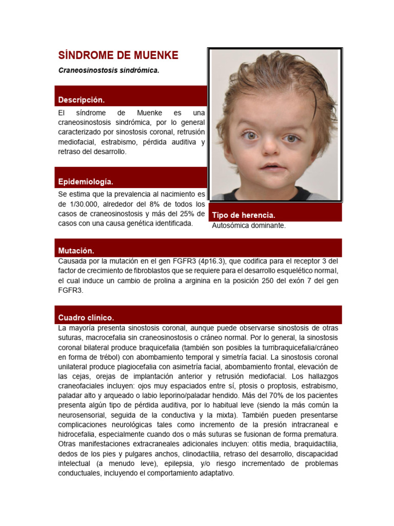 Sindrome de Muenke | Descargar gratis PDF | Pediatría | Medicina