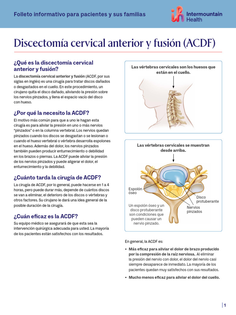 Guía sobre Discectomía Cervical ACDF | PDF | Cirugía | Hueso