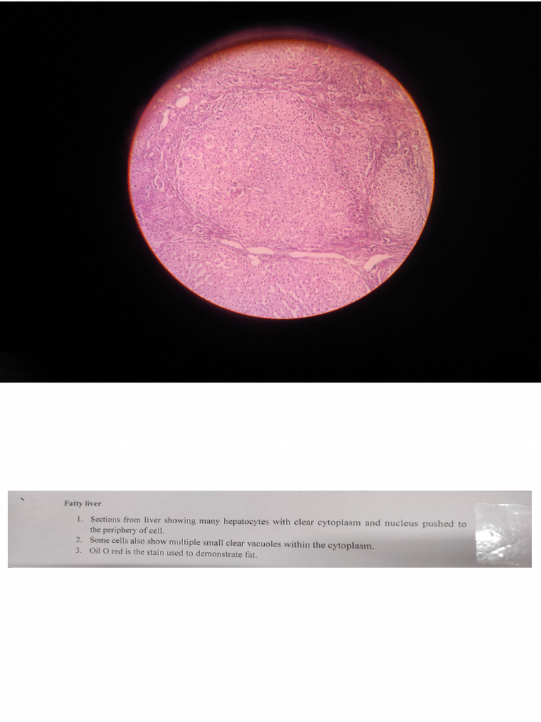 Pathology Slides | PDF