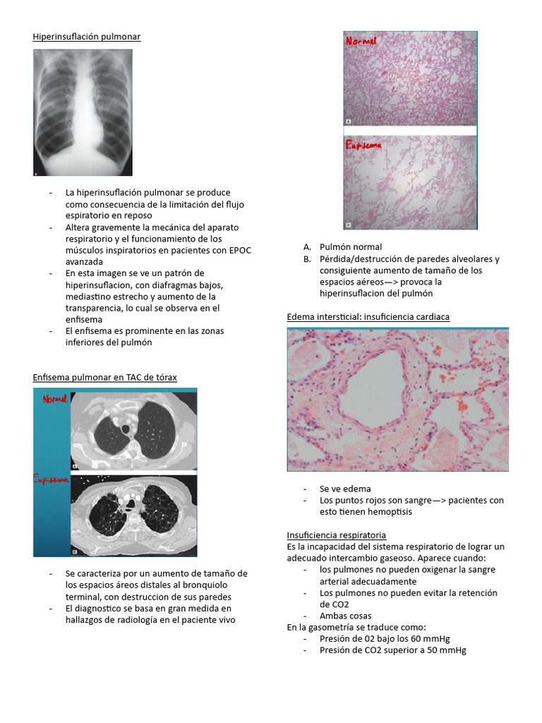 Enfermedades Pulmonares Obstructivas | PDF | Pulmón | Asma