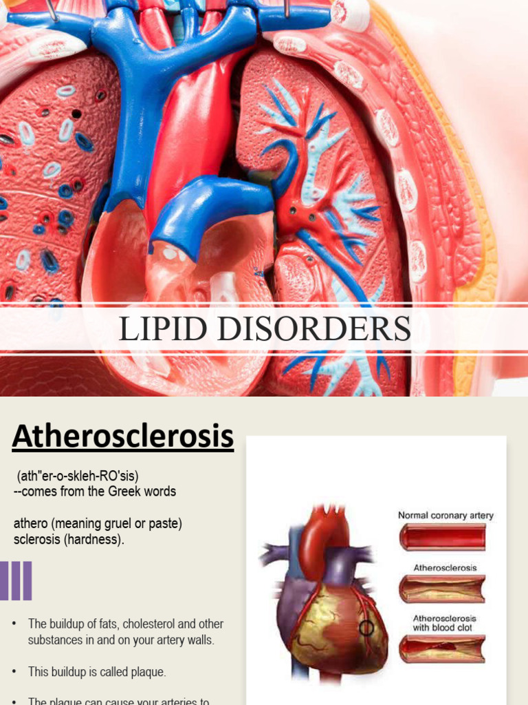 Lipid Disorders | PDF | Hypercholesterolemia | Atherosclerosis