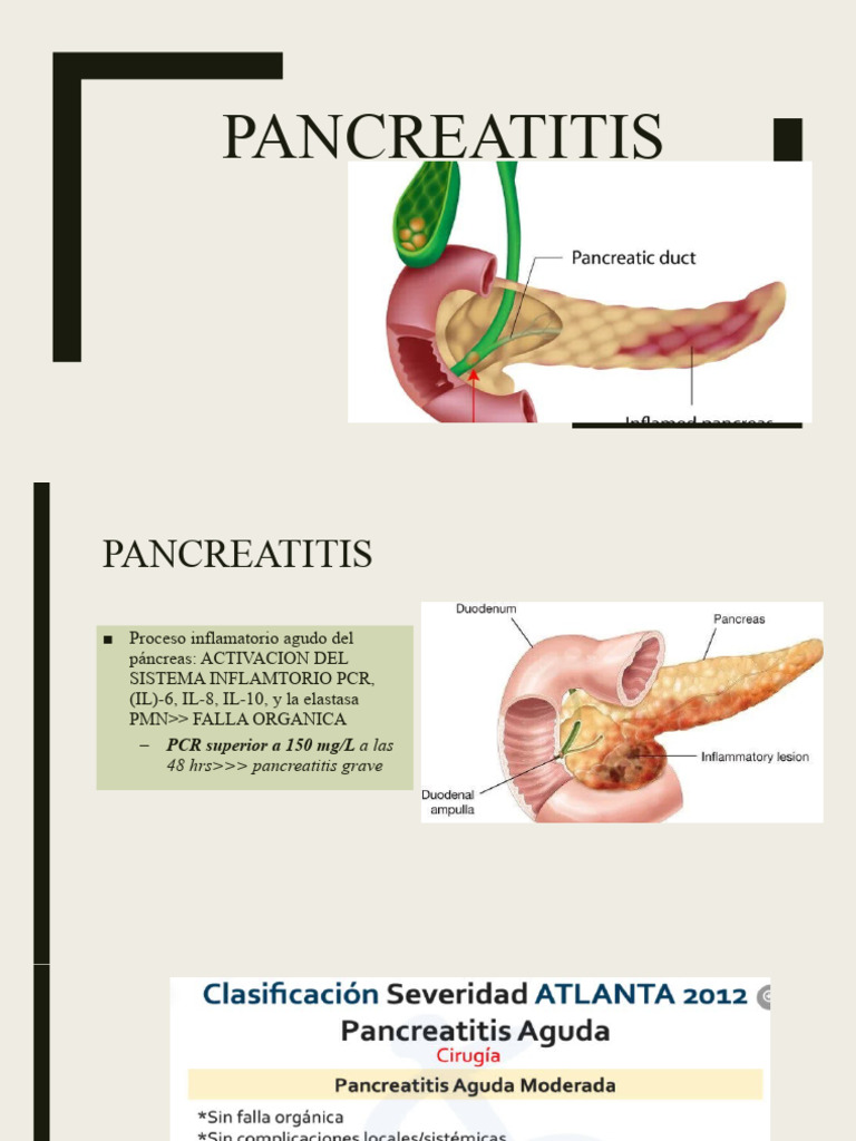 Guía de Pancreatitis: Causas y Manejo | PDF | Cocina, comidas y vino