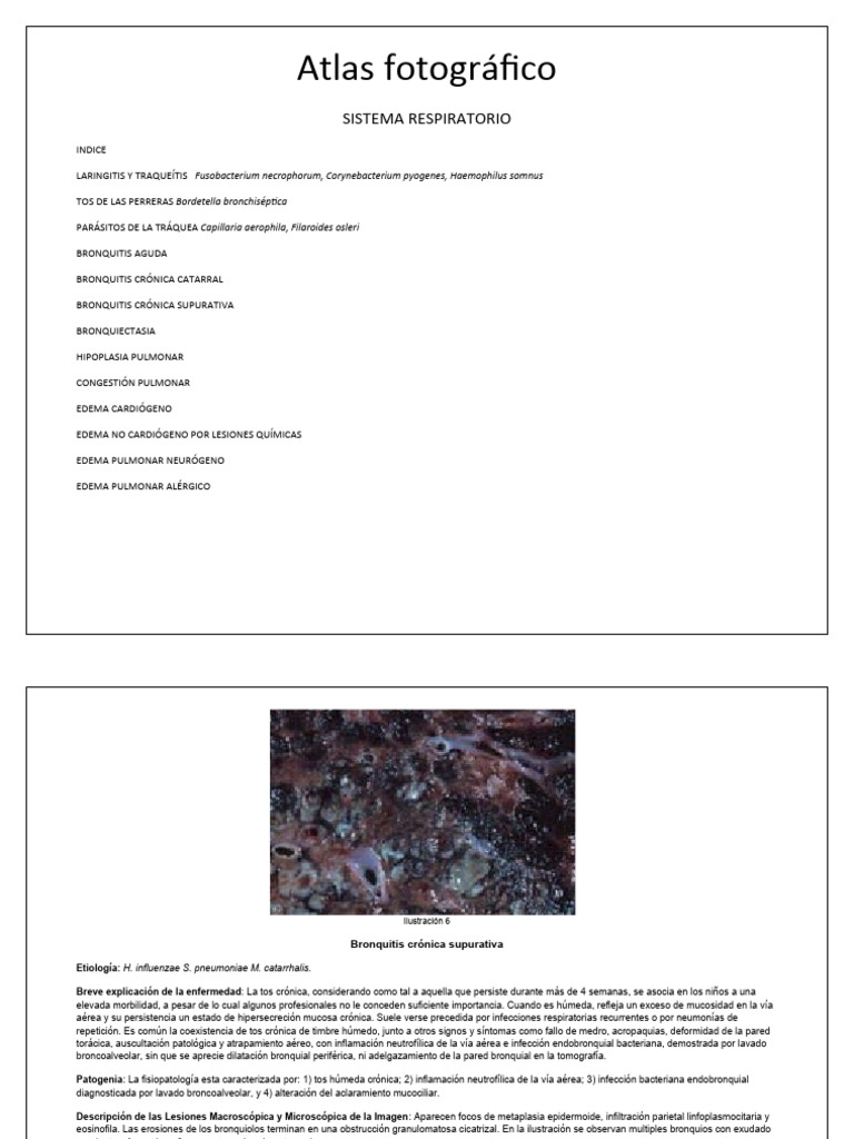 Practica 2 Pato Atlas | PDF | Tos | Pulmón