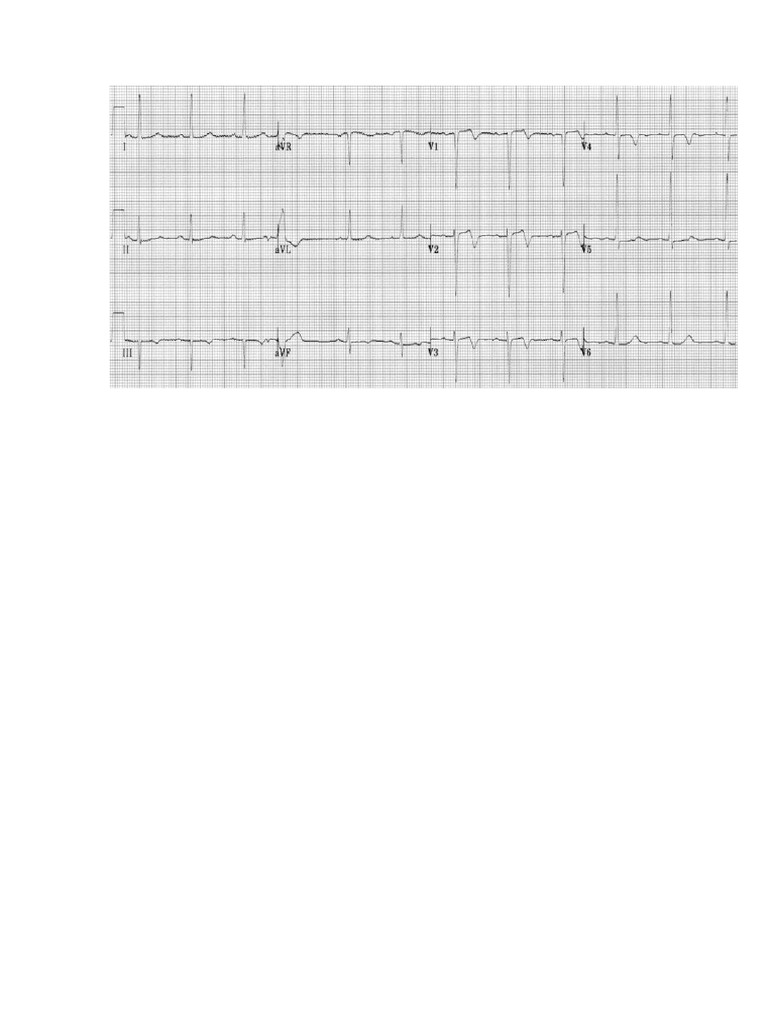 Ecg 7 | PDF