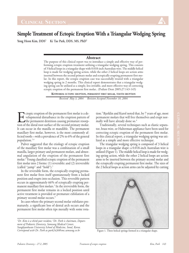 Simple Treatment of Ectopic Eruption With A Triangular Wedging Spring ...