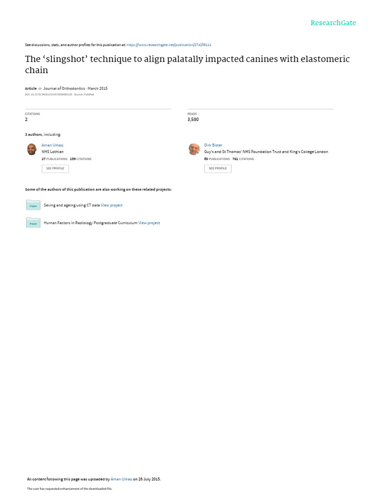 The Slingshot' Technique To Align Palatally Impacted Canines With ...