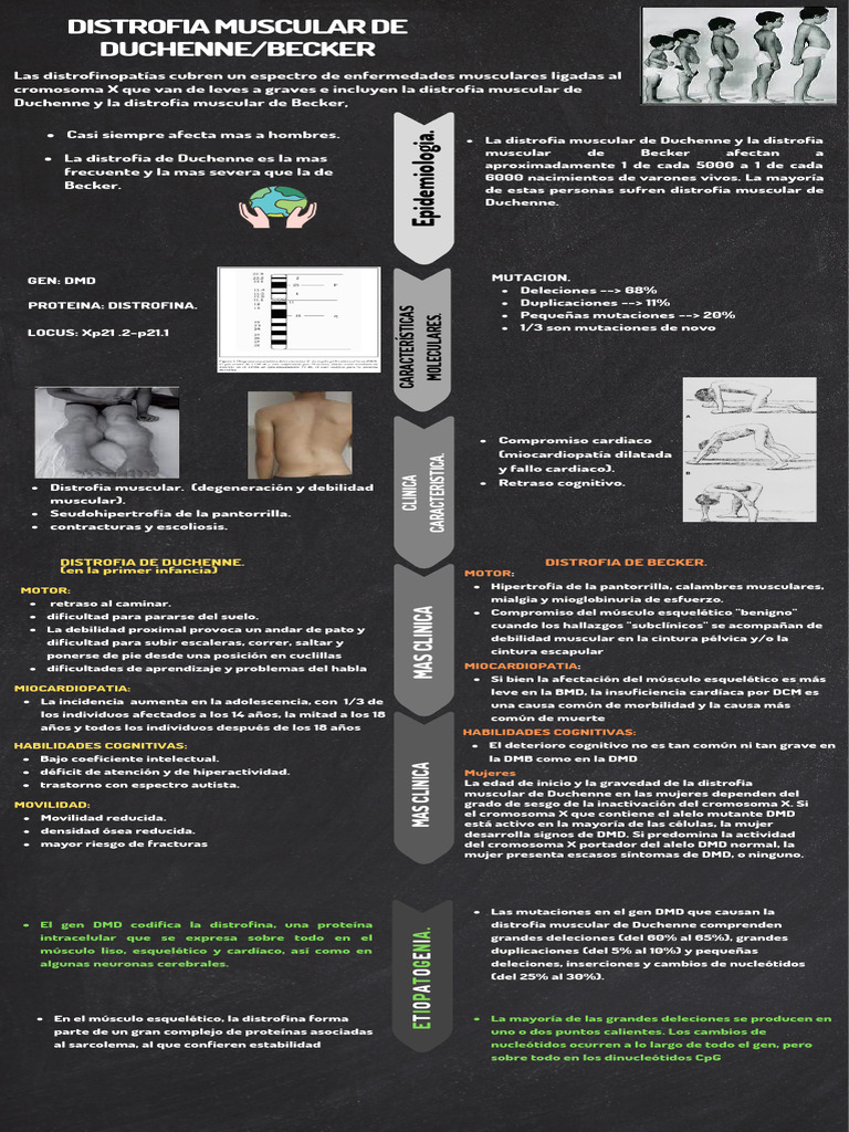 Distrofia muscular de Duchenne y Becker | PDF | Medicina CLINICA ...