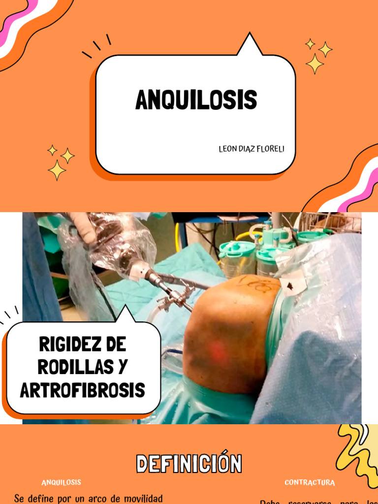 Anquilosis Exposicion | PDF | Rodilla | Medicina CLINICA