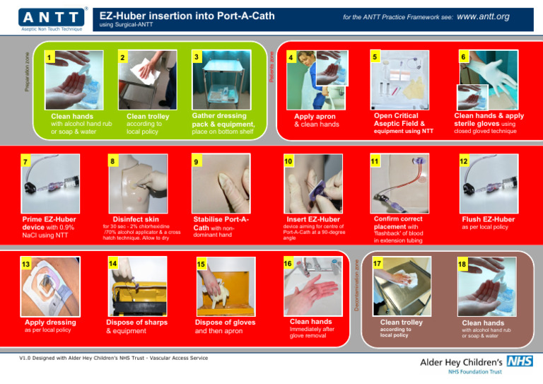 Ez Huber Insertion Into Port A Cath Draft | PDF | Medical Procedures ...