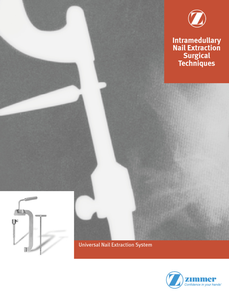 Intramedullary Nail Extraction Surgical Technique | PDF | Nut (Hardware ...