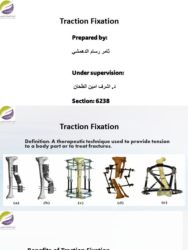 Traction Fixation | PDF | Spinal Cord Injury | Nervous System