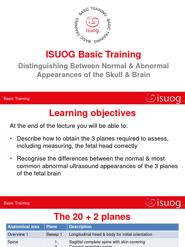 ISUOG Basic Training: Distinguishing Between Normal & Abnormal Appearances of The Skull & Brain ...