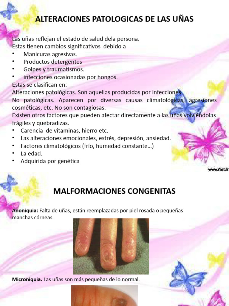 Alteraciones de las Uñas | PDF | Clavo (anatomía) | Enfermedades y ...