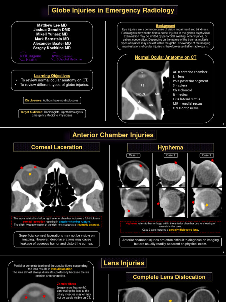 Ocular Trauma CT Imaging Guide | PDF